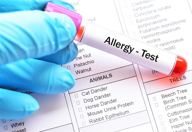 Why an Allergy Comprehensive Profile is Essential for Your Health ...